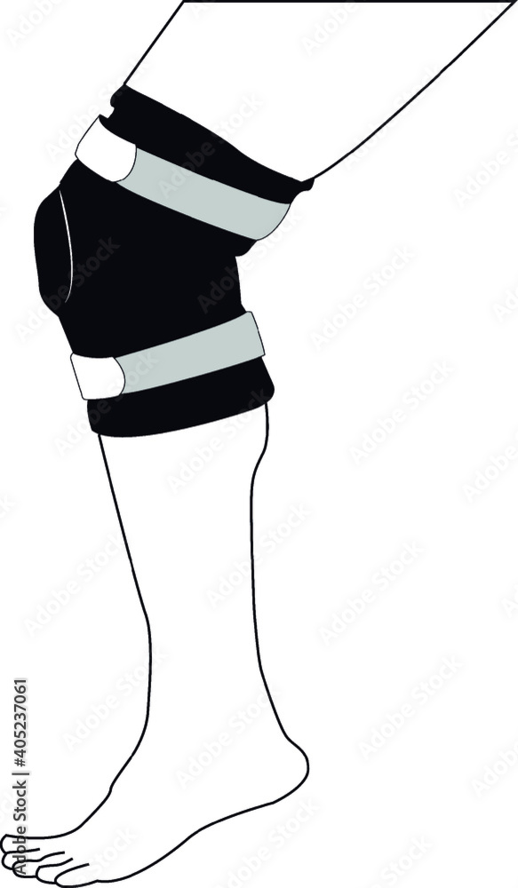 rodillera ortopédica en la rodilla derecha. Ilustración 3 colores ...