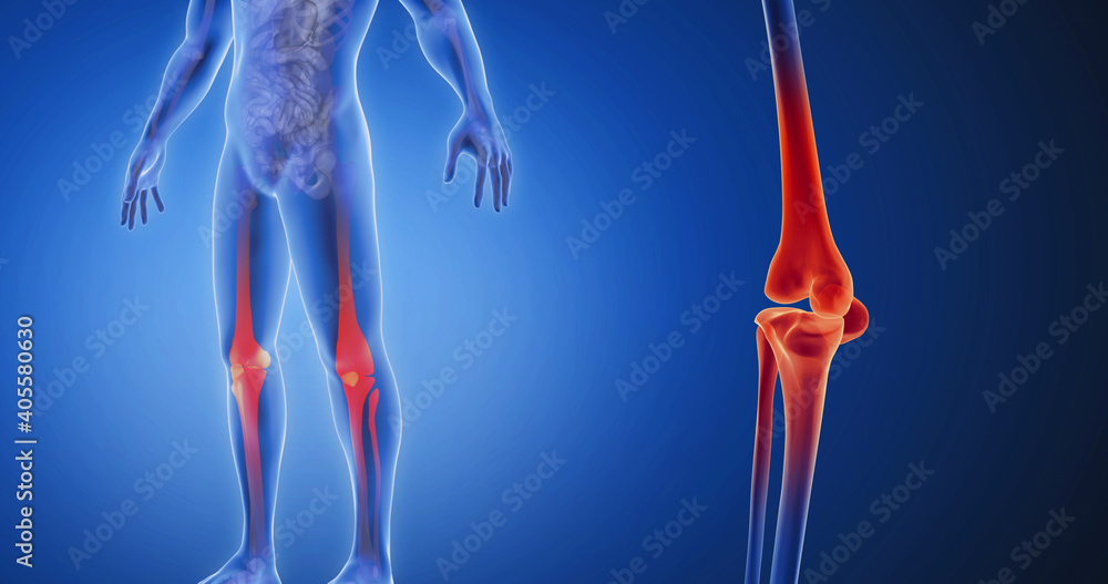 Knee, patella bone x-ray style, internal organs 3D render, anatomy of ...