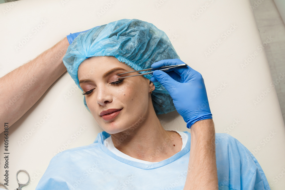 Blepharoplasty markup close-up on the face before the plastic surgery ...