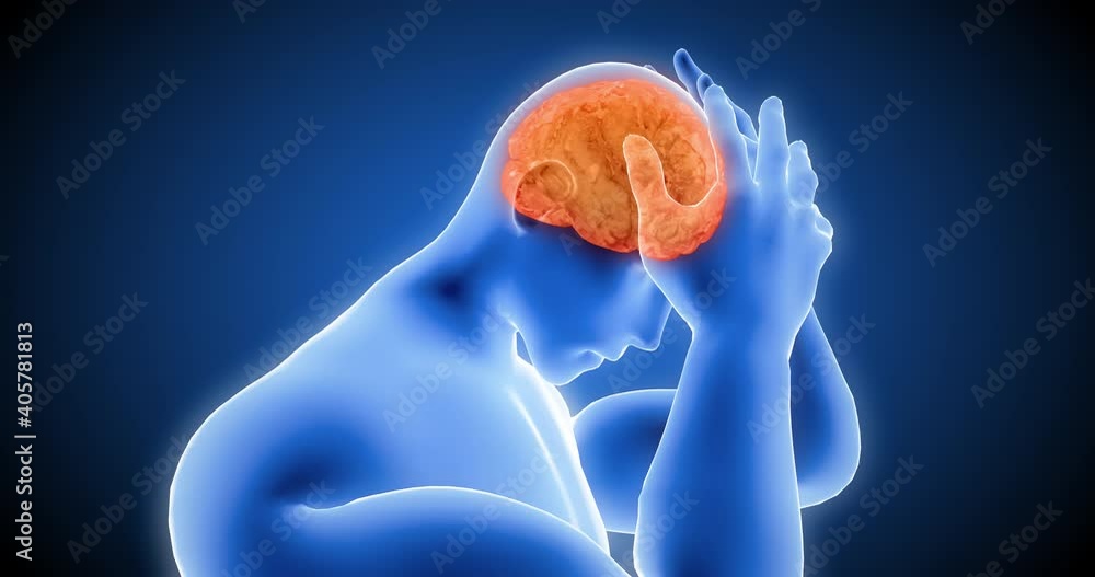 Headache, human skeleton, bone scan, joint, medical screen 3D render ...