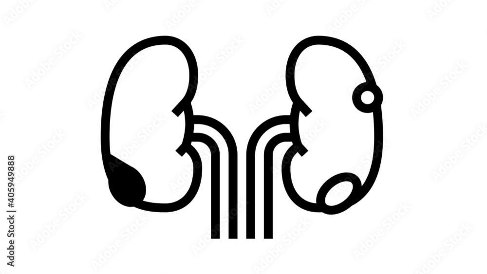 glomerulonephritis kidney disease animated black icon ...