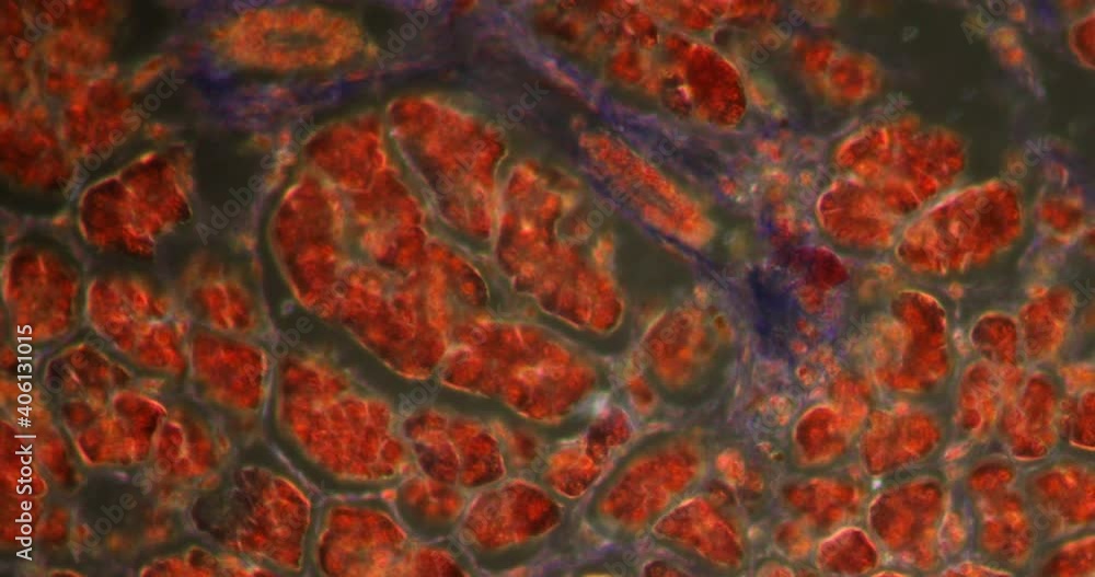 pancreas with islet cells in Darkfield tissue under the microscope 200x ...