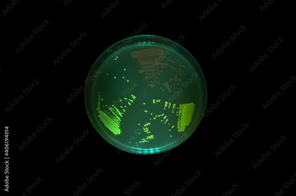 Petri dish of bacteria expressing fluorescent proteins under blue light ...