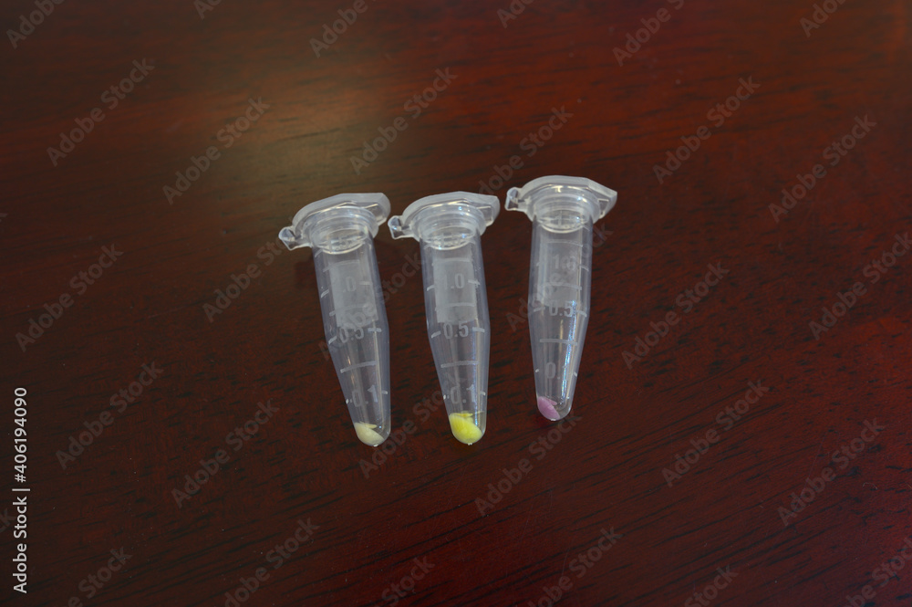Eppendorf tubes of bacterial cell pellets under white light; E. coli ...