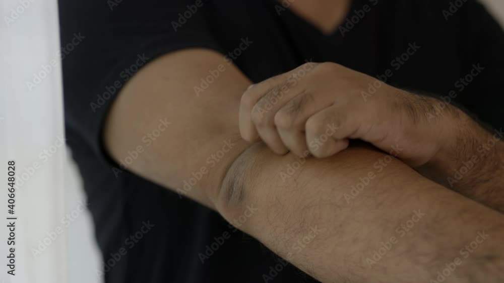The young man has a skin disease. He has an itch in his arms. He ...