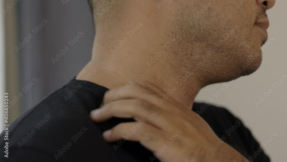 Video Stock The young man has a skin disease. He has an itch at the ...