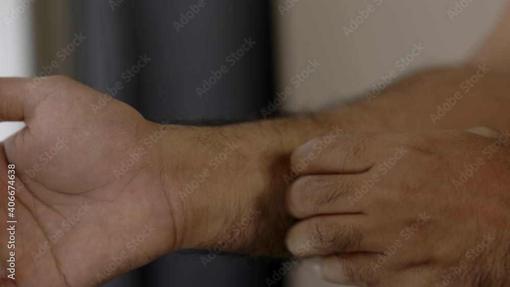Young man suffering from skin disease He has an itchy wrist. He ...