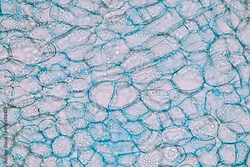 Host cells with spores (mold) are inside wood under the microscope for ...