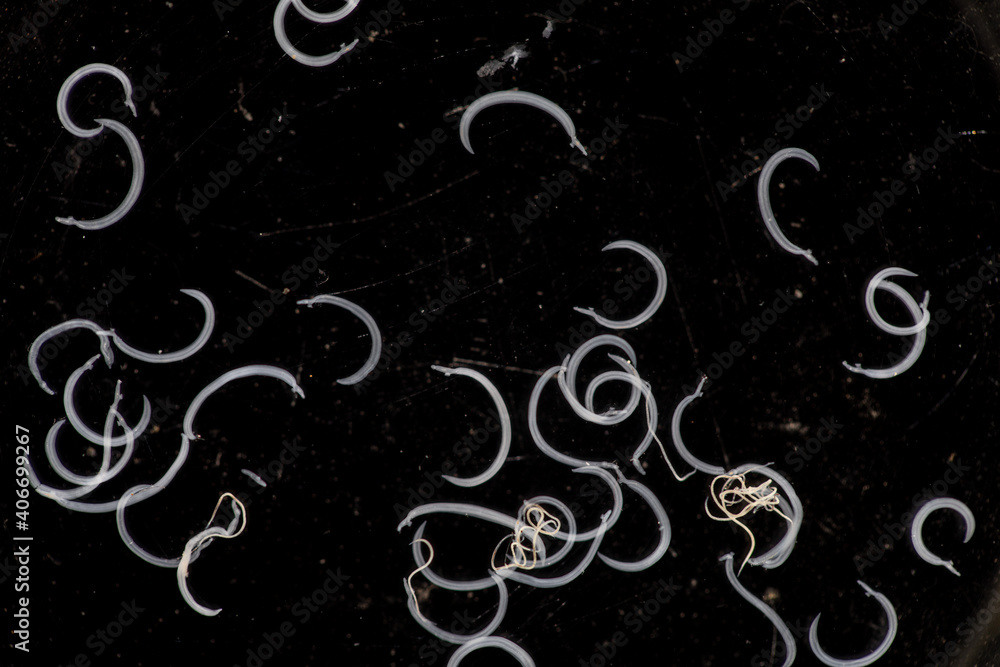 Schistosoma is a genus of trematodes, commonly known as blood flukes ...