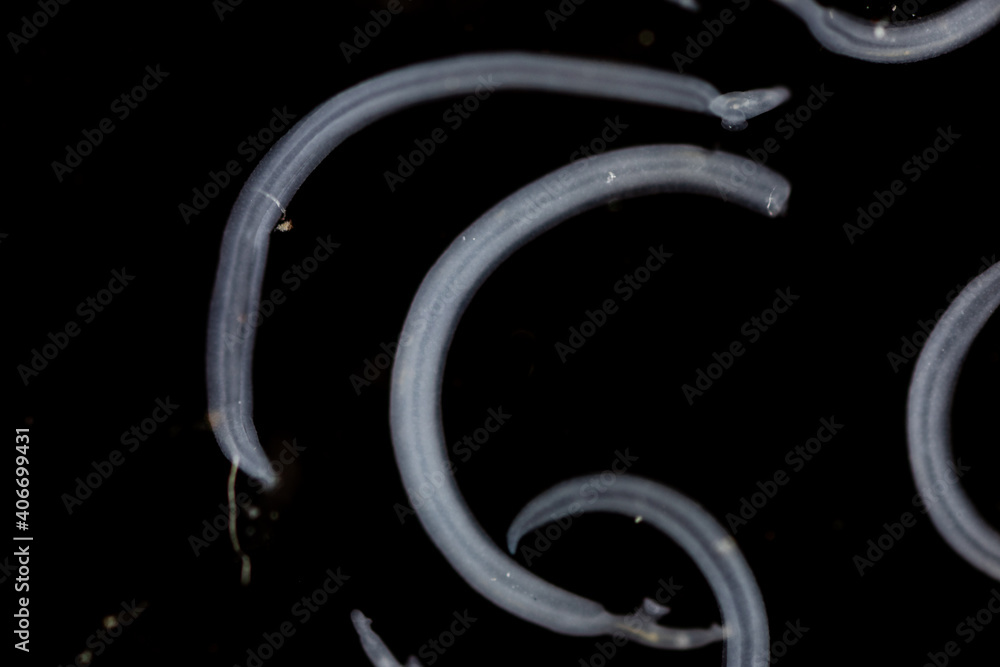 Schistosoma is a genus of trematodes, commonly known as blood flukes ...