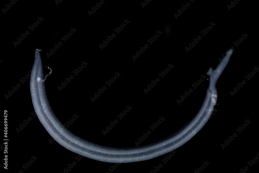 Schistosoma is a genus of trematodes, commonly known as blood flukes ...
