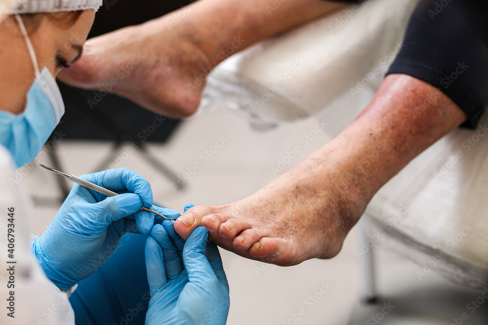 medical foot care, problems of the elderly, diseases of the feet and ...