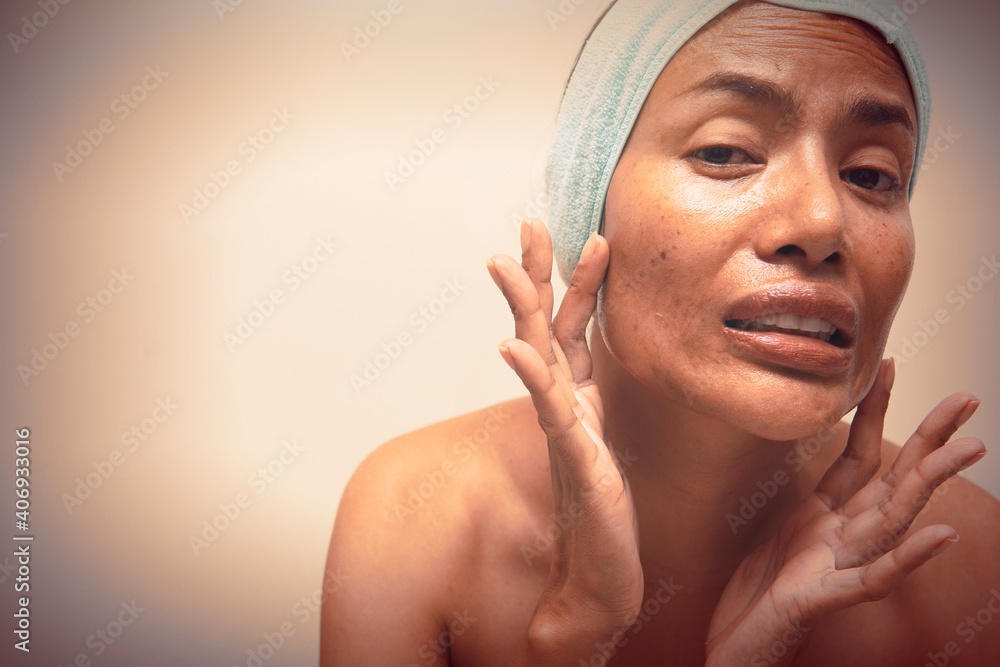 crazy woman with very oily skin Stock Photo | Adobe Stock