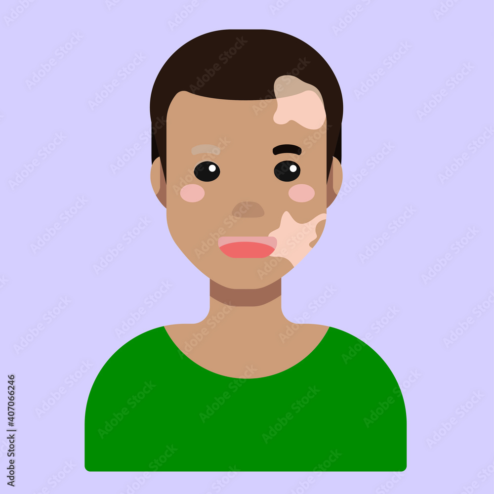 Flat cartoon vector illustration, that displays people pigmentation ...