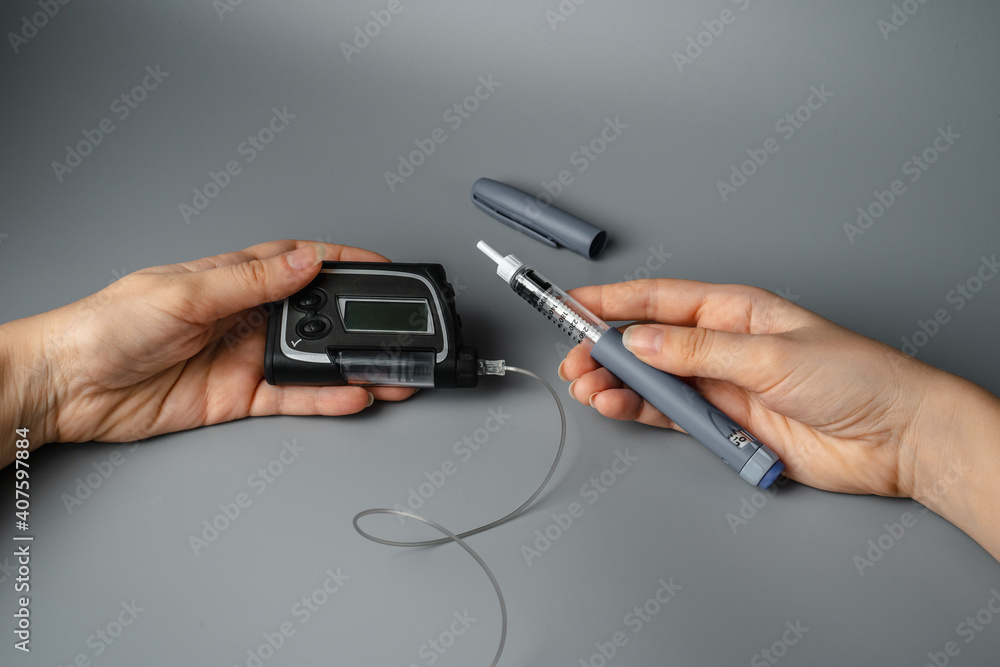young woman holds an insulin syringe and an insulin pump in her hands ...