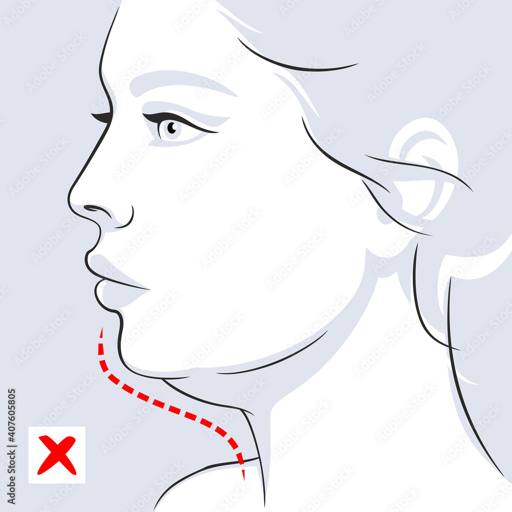 Poster Woman profile double chin before. Woman face. Vector ...