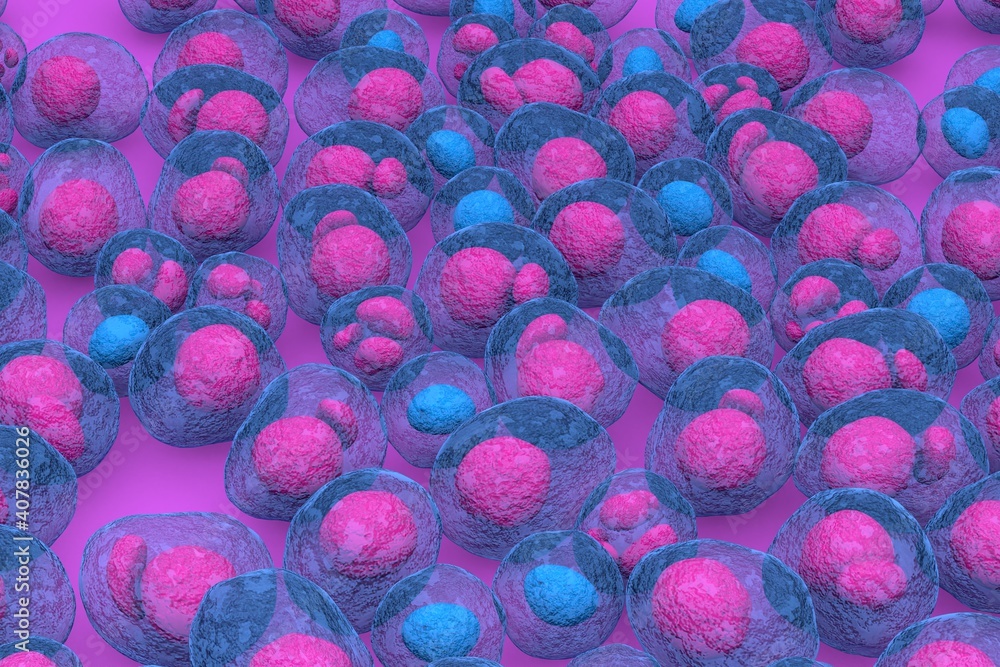 Multiple Myeloma multiplex leukemia cancer 3d color render illustration ...