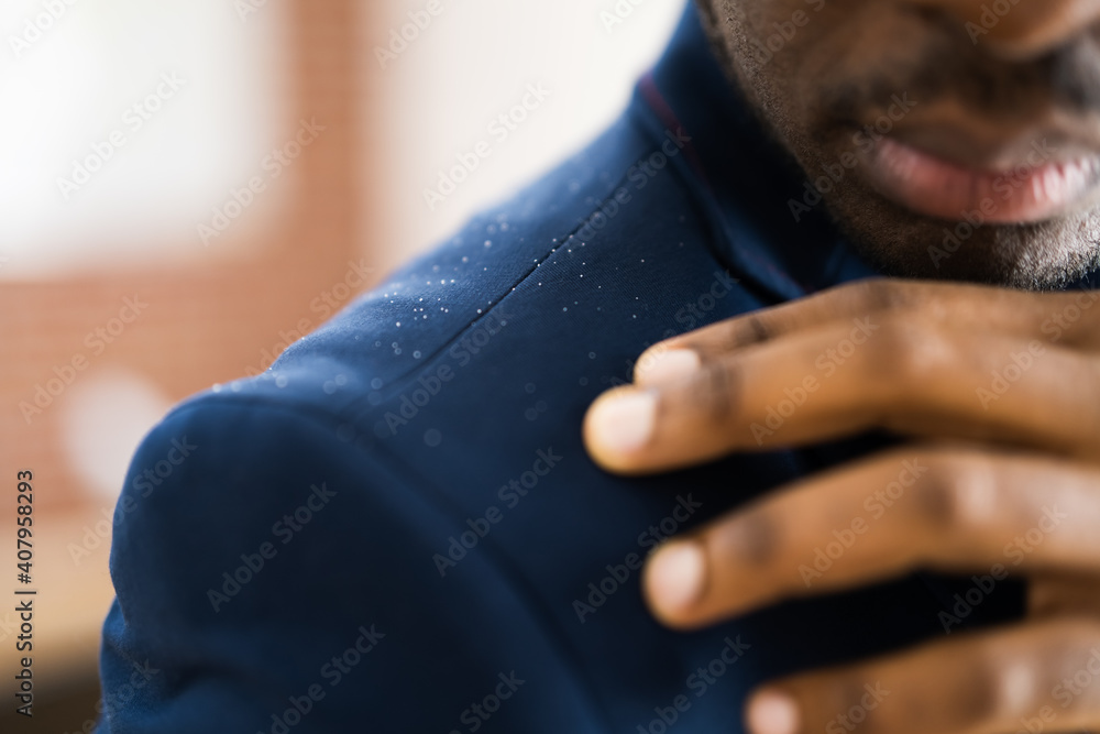 Man Brushing Dandruff From Dirty Suit. Itchy Head Stock Photo | Adobe Stock