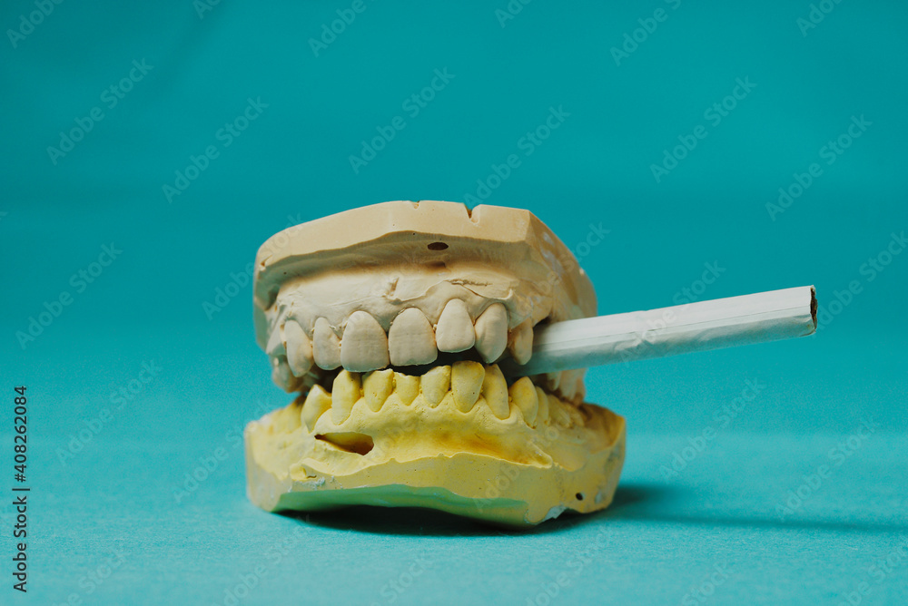 cast of teeth and cigarette on a light blue background. smoke and ...