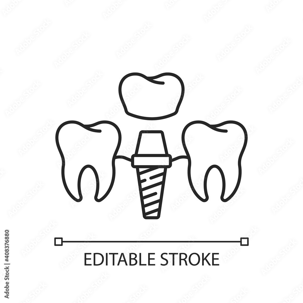 Dental implants procedure linear icon. Tooth recovery process. Dental ...