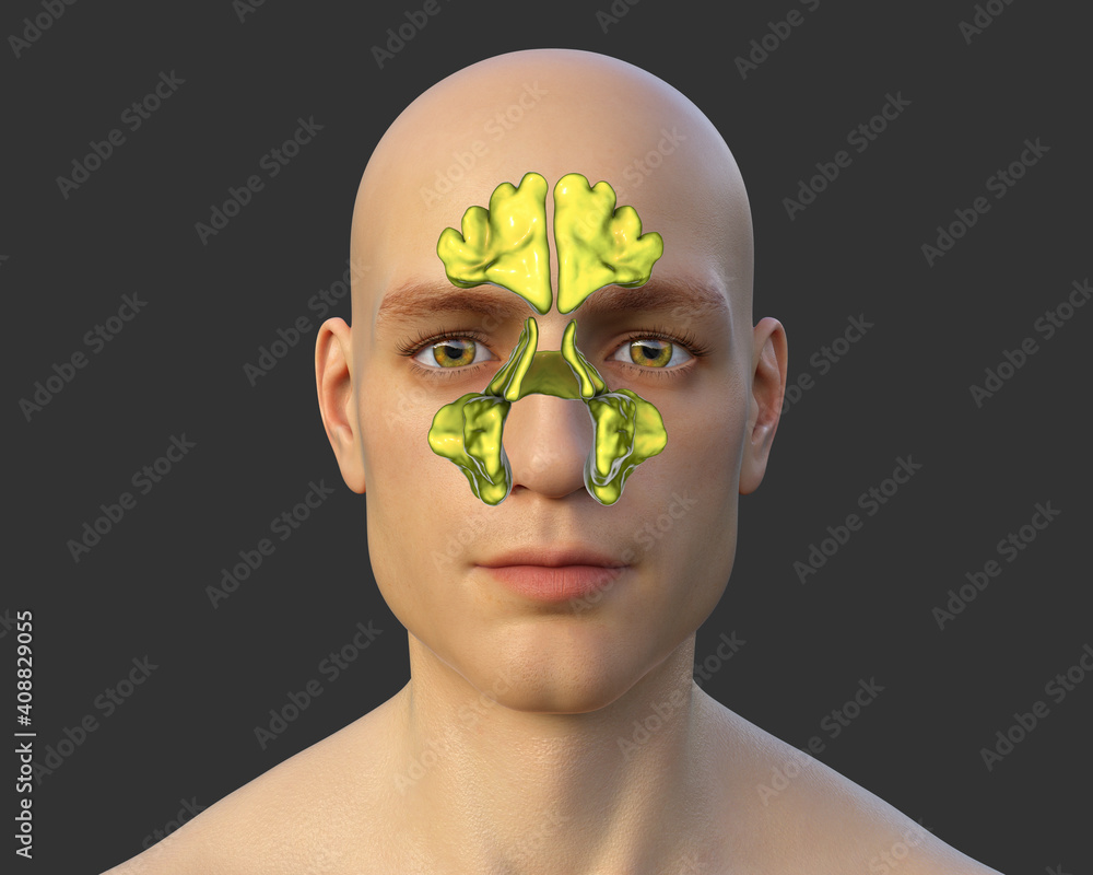 Anatomy of paranasal sinuses Stock Illustration | Adobe Stock