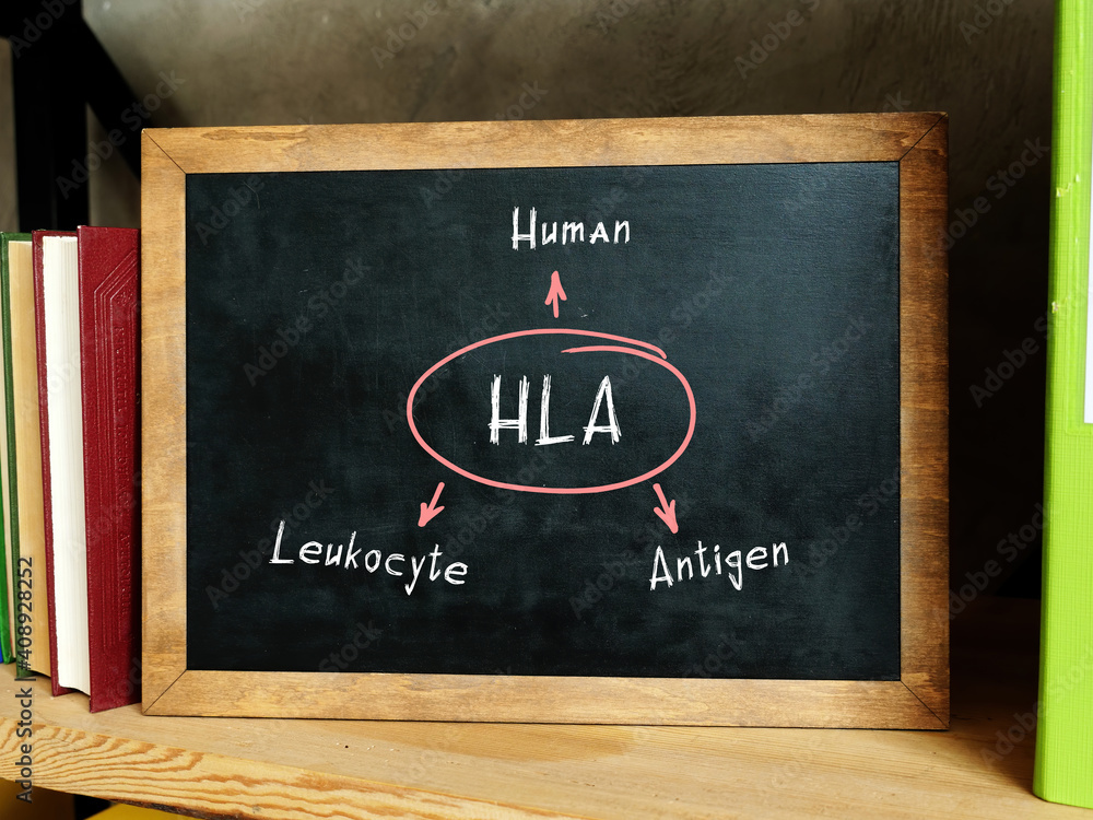 Text HLA Human Leukocyte Antigen on Concept photo. Still life with ...