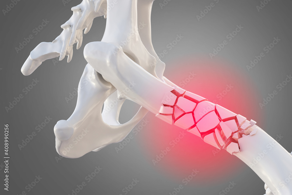 Broken dog femur bone with visible other bones Stock Illustration ...