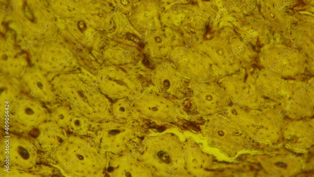 Tissue of a compact bone under the microscope (400x). Stock Photo ...