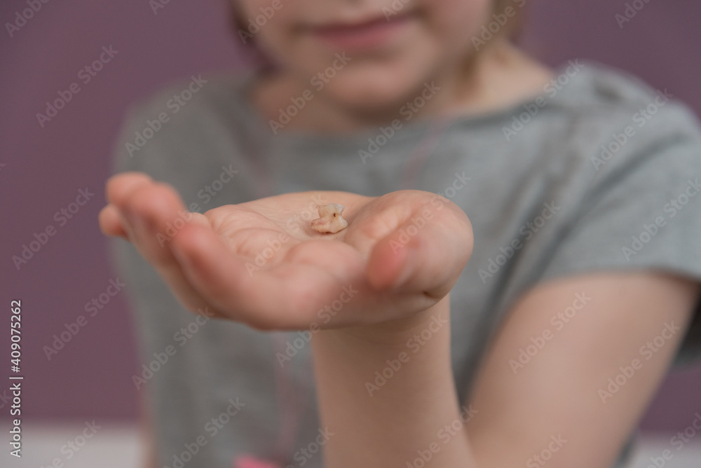 The child holds a lost tooth in his hand. There are traces of caries on ...