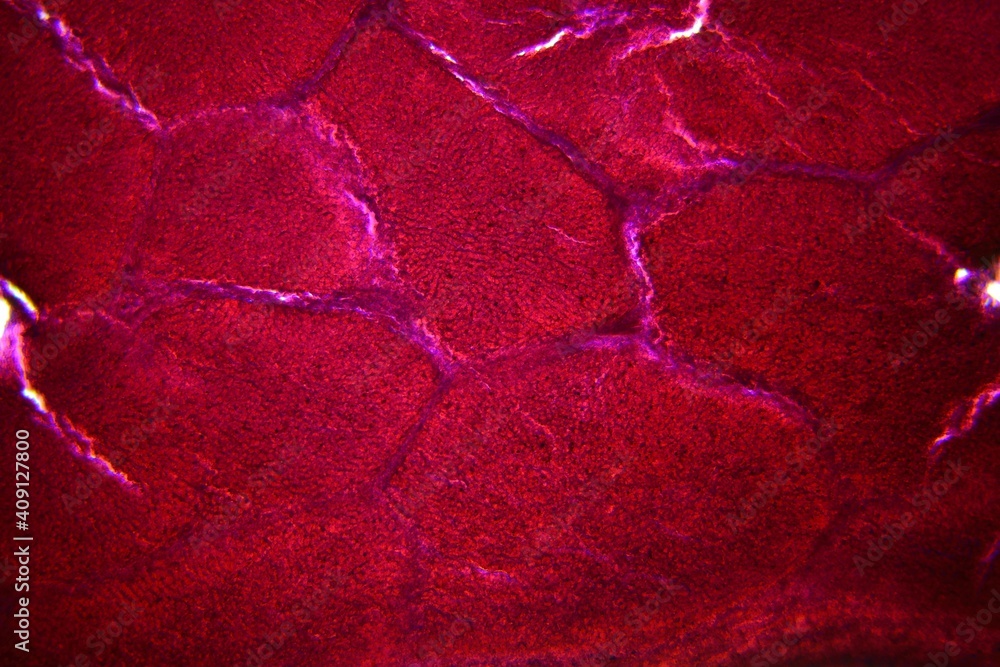 Liver cells under the light microscope. Leberzellen unter dem ...