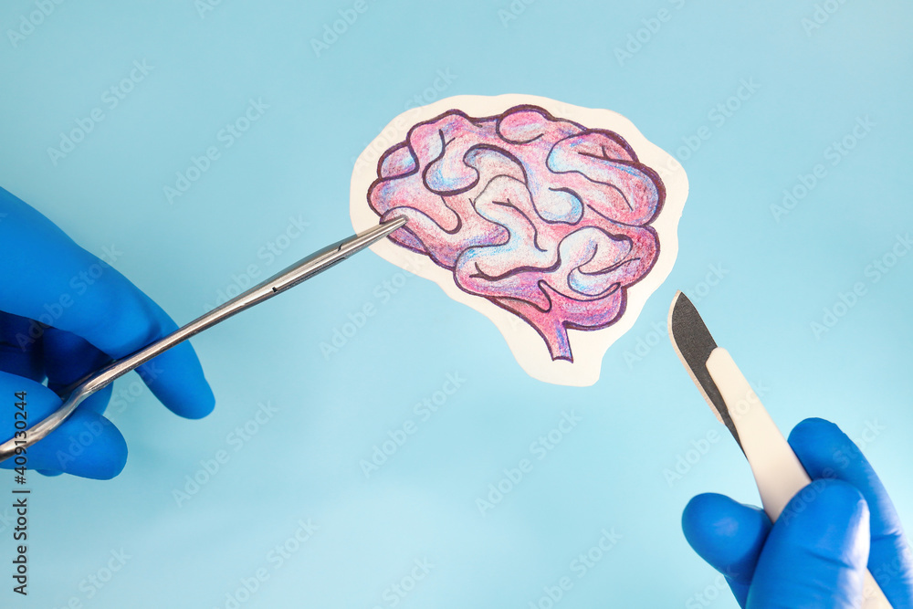emergency surgery on human brain. pencil drawing. Stock Photo | Adobe Stock