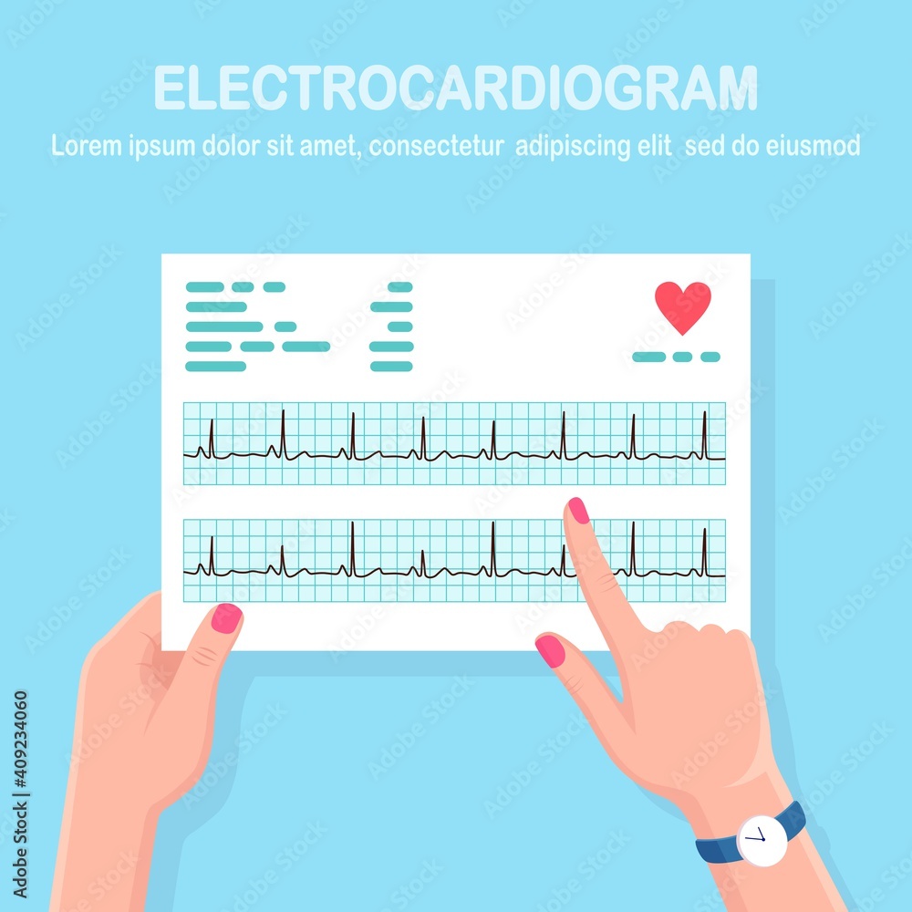 Cardiogram in doctor hand. Diagnosis cardiovascular disease. Chart of ...