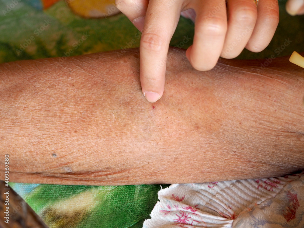 Finger finding venous blood vessel for insert needle to draw blood ...