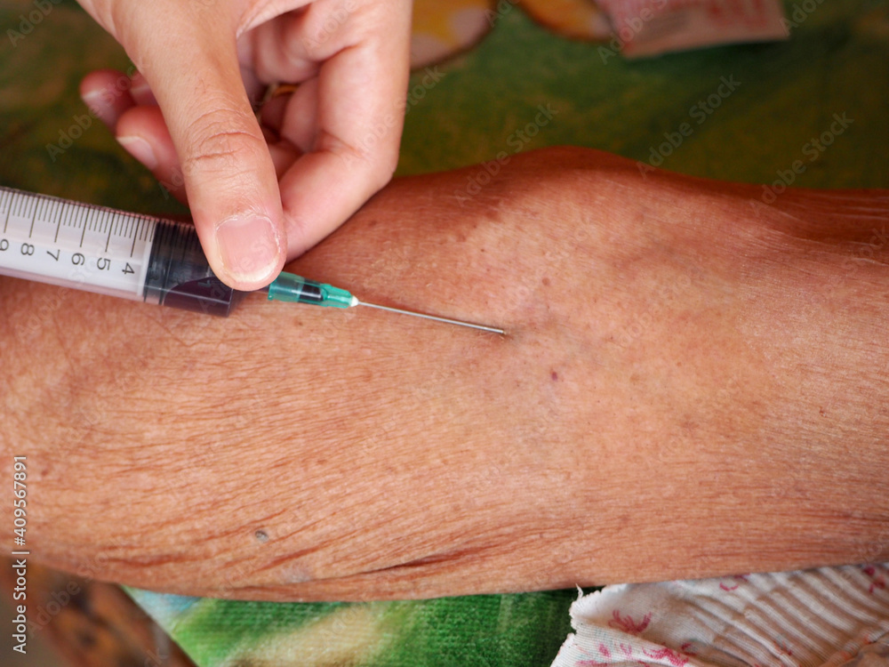 Hand collecting venous puncture of patient .Nurse collecting blood from ...