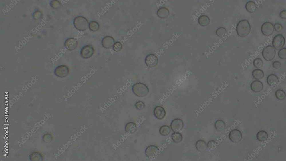 Vídeo do Stock: Microscopy of yeast cells (Saccharomyces cerevisiae ...