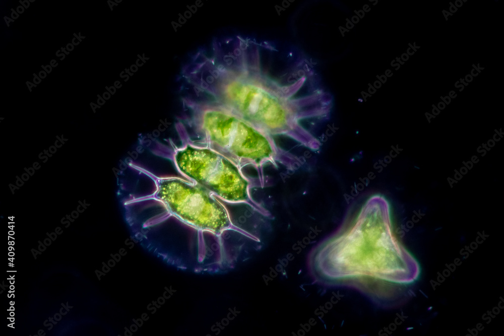 Protozoa and Green Algae in waste water under the microscope. Stock ...