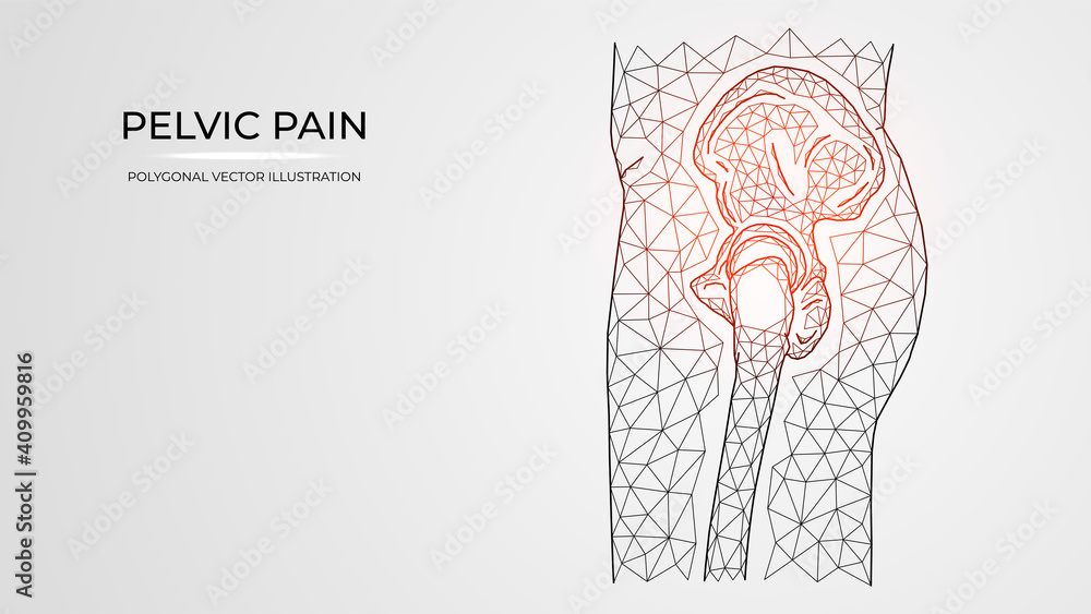 Polygonal vector illustration of pain, inflammation or injury in the ...