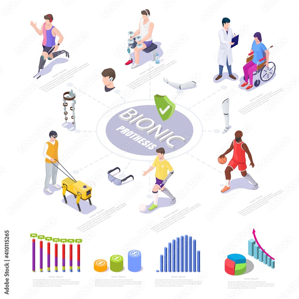 Bionic prosthesis isometric infographic, flat vector illustration ...
