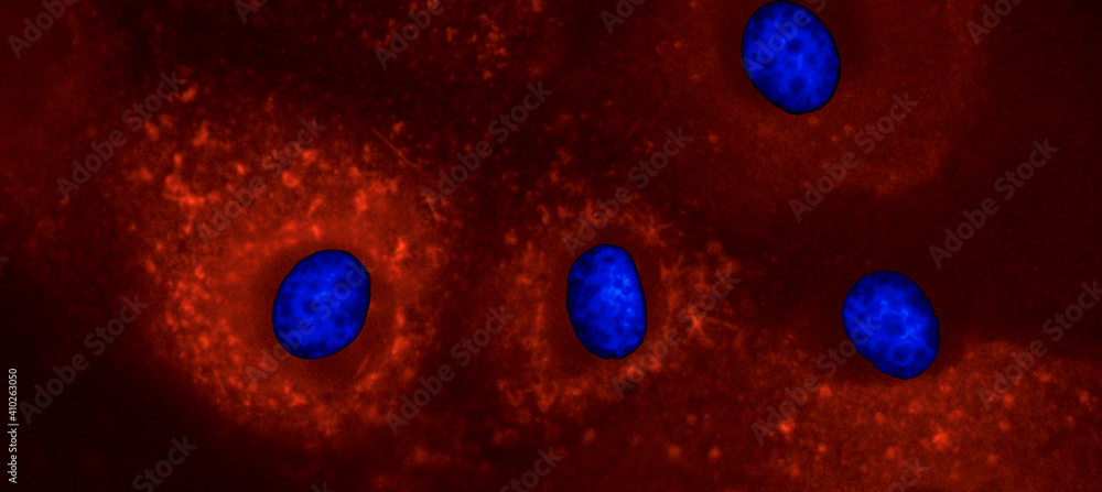 Research on Sars-Cov-2 vaccine: coronavirus infected Vero cells reacting to antibodies raised ...