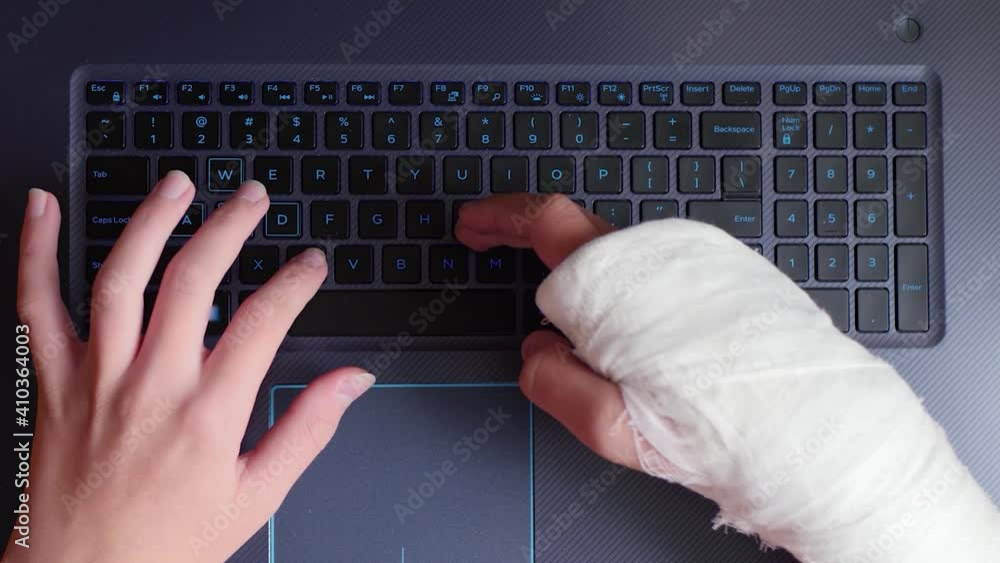 Teenager's hand in cast works with a laptop using productive work ...
