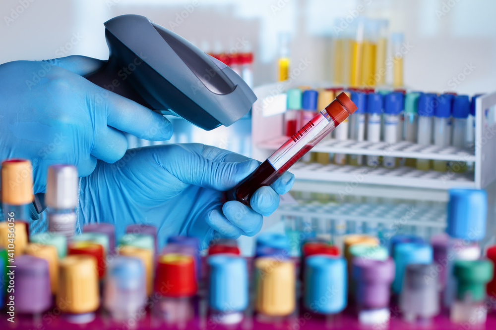 Working on the identification of blood sample tubes with the barcode ...