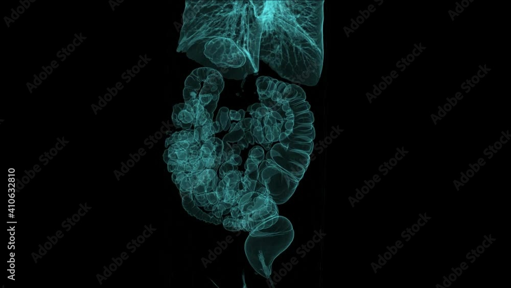 Body Ct Scan Image, Radiography X-Ray Examination, Mri Tomography ...