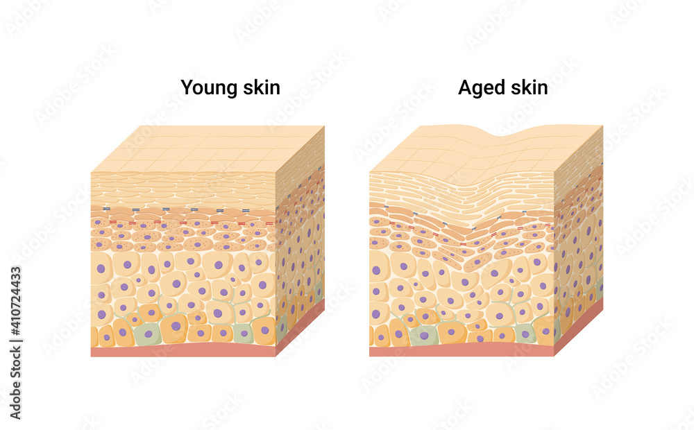 Vector illustration of young and aged skin Stock Vector | Adobe Stock