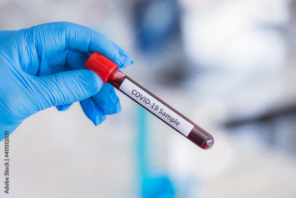 Researchers holding blood tube in life science laboratory. Male ...
