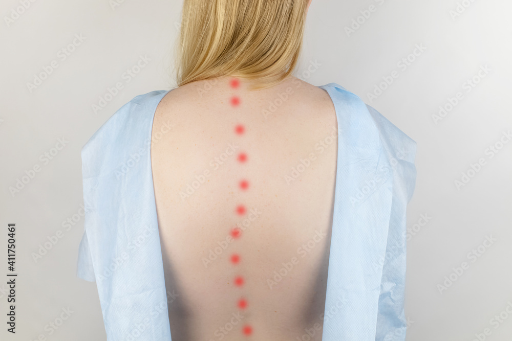 A woman at the doctor's appointment with back pain. Treatment of spinal ...