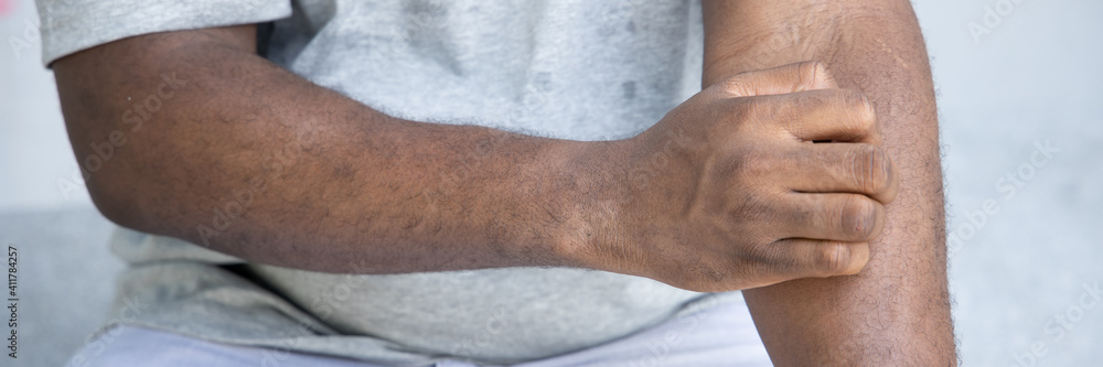 Man scratching suffering from itching arm skin; sick African man ...