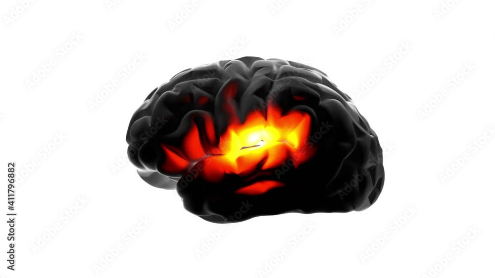 Human brain damage, red inflammatory process on an isolated white ...
