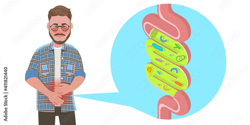 3D Isometric Flat Vector Conceptual Illustration of Gut Inflammation ...