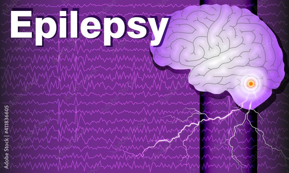 Human brain with epilepsy activity, epilepsy awareness, vector ...