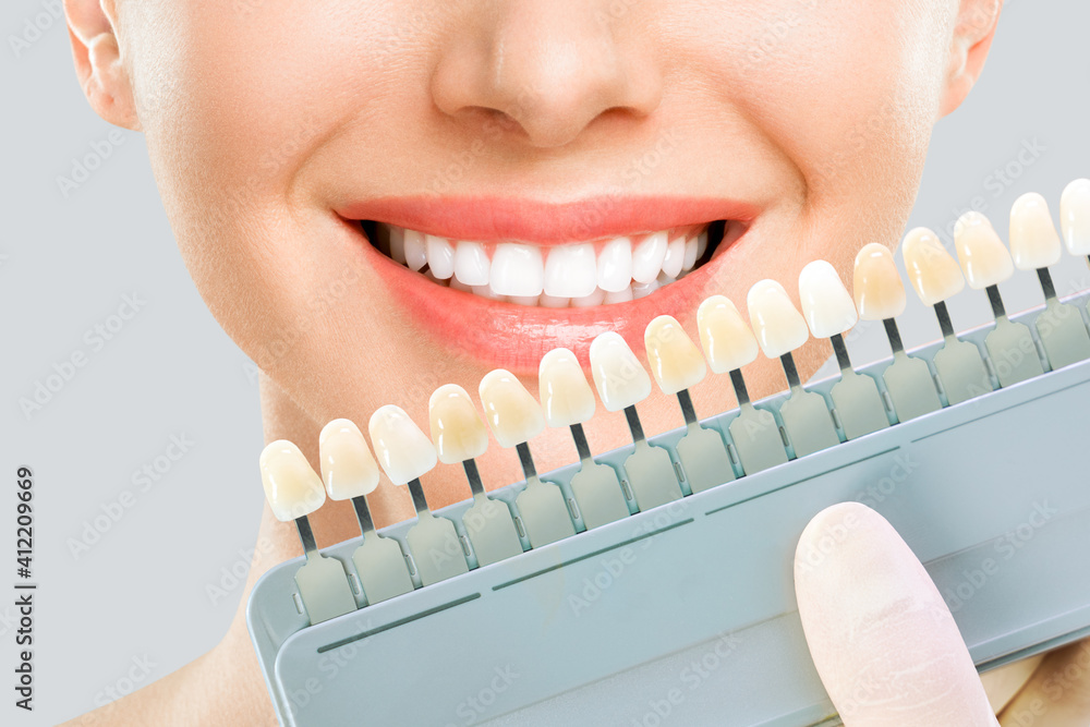 Smiling young woman. Cosmetological teeth whitening in a dental clinic ...